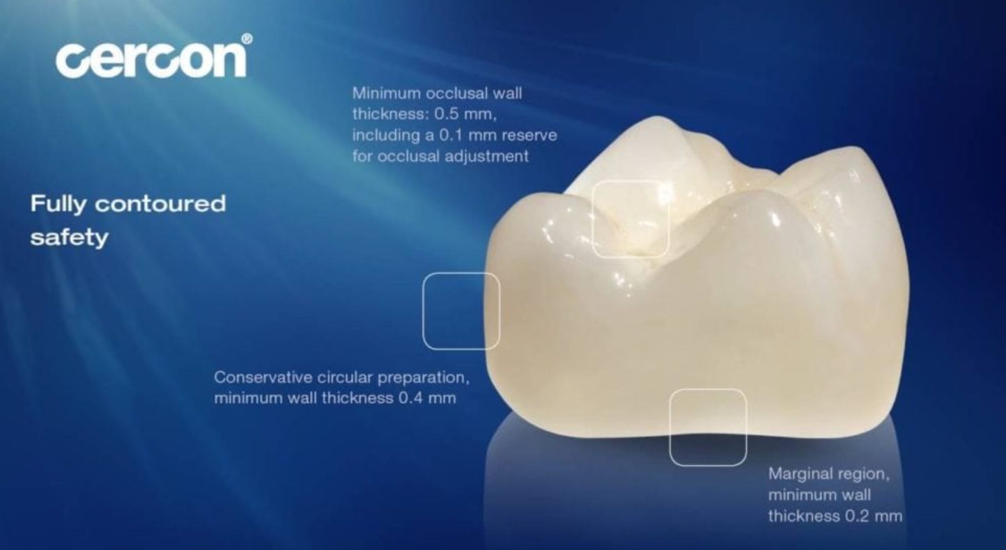 Răng sứ Cercon và những ưu điểm nổi bật