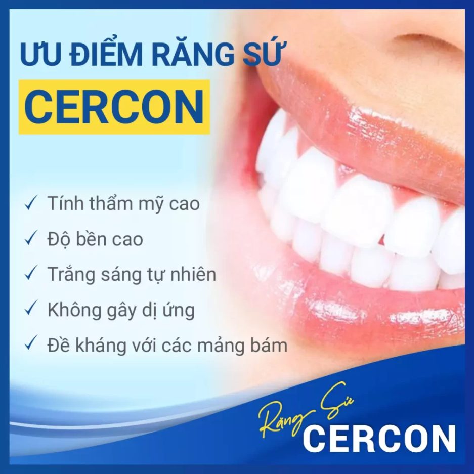 Răng sứ Cercon và những ưu điểm nổi bật